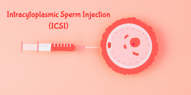 Intracytoplasmic Sperm Injection (ICSI) | by KD Blossom Hospital | Medium