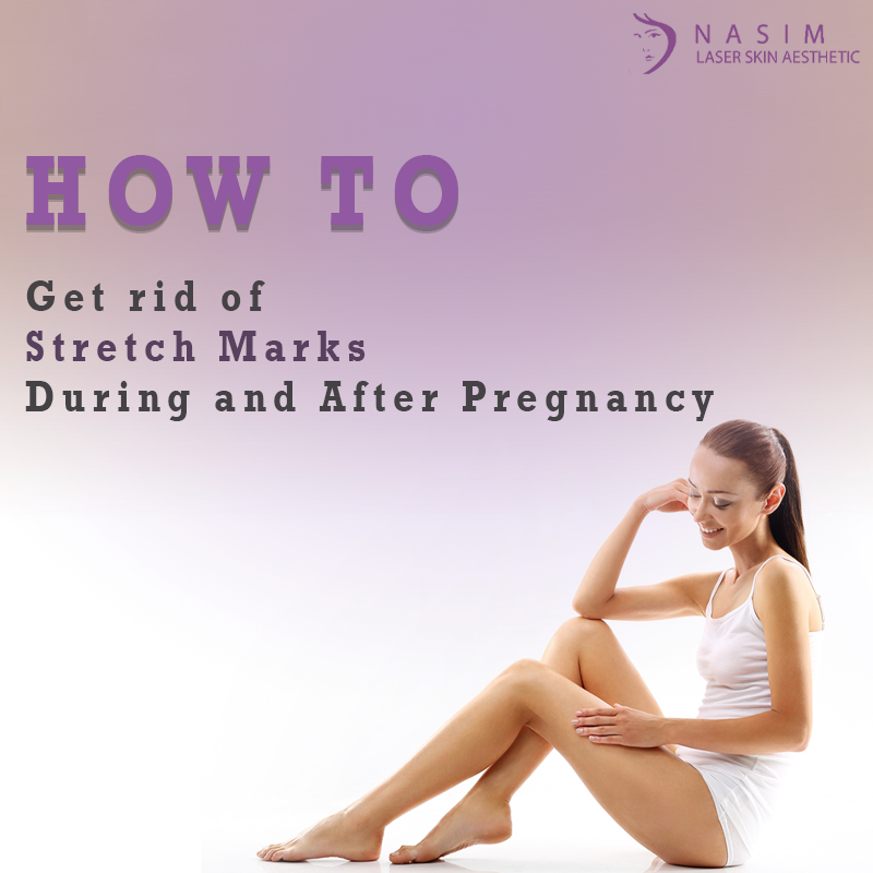 How to reduce stretch marks during and after pregnancy | by farwa anees | Medium