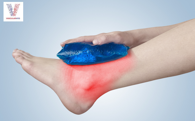 Don’t Lose a Limb: Recognizing and Responding to Acute Limb Ischemia ...