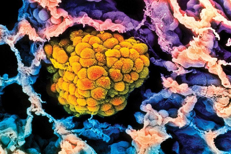 Boom del gene editing: via libera a nuove sperimentazioni CRISPR | by ...