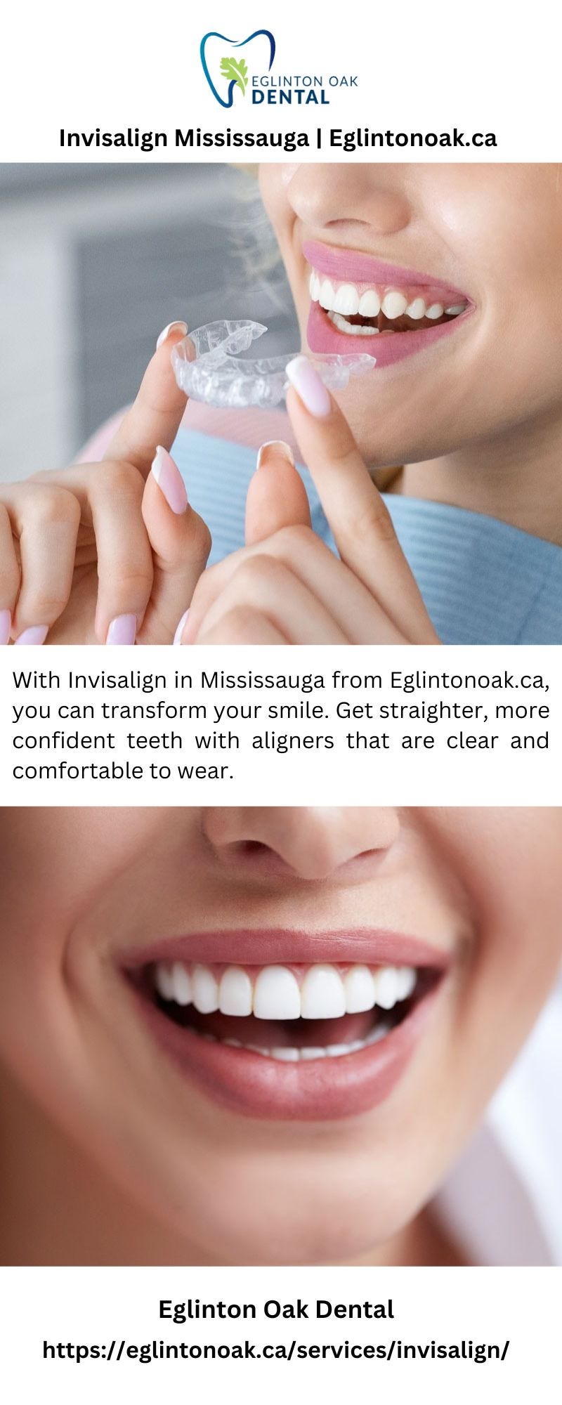 Invisalign Mississauga | Eglintonoak.ca - Eglinton Oak Dental - Medium