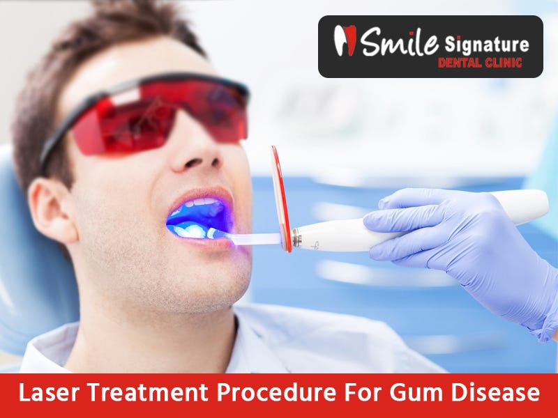 Laser Treatment Procedure For Gum Disease | by Anwesha Das | Medium