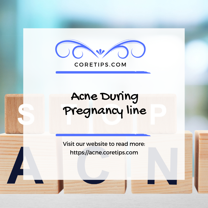 Acne During Pregnancy. Pregnancy is a time of great excitement… | by ...