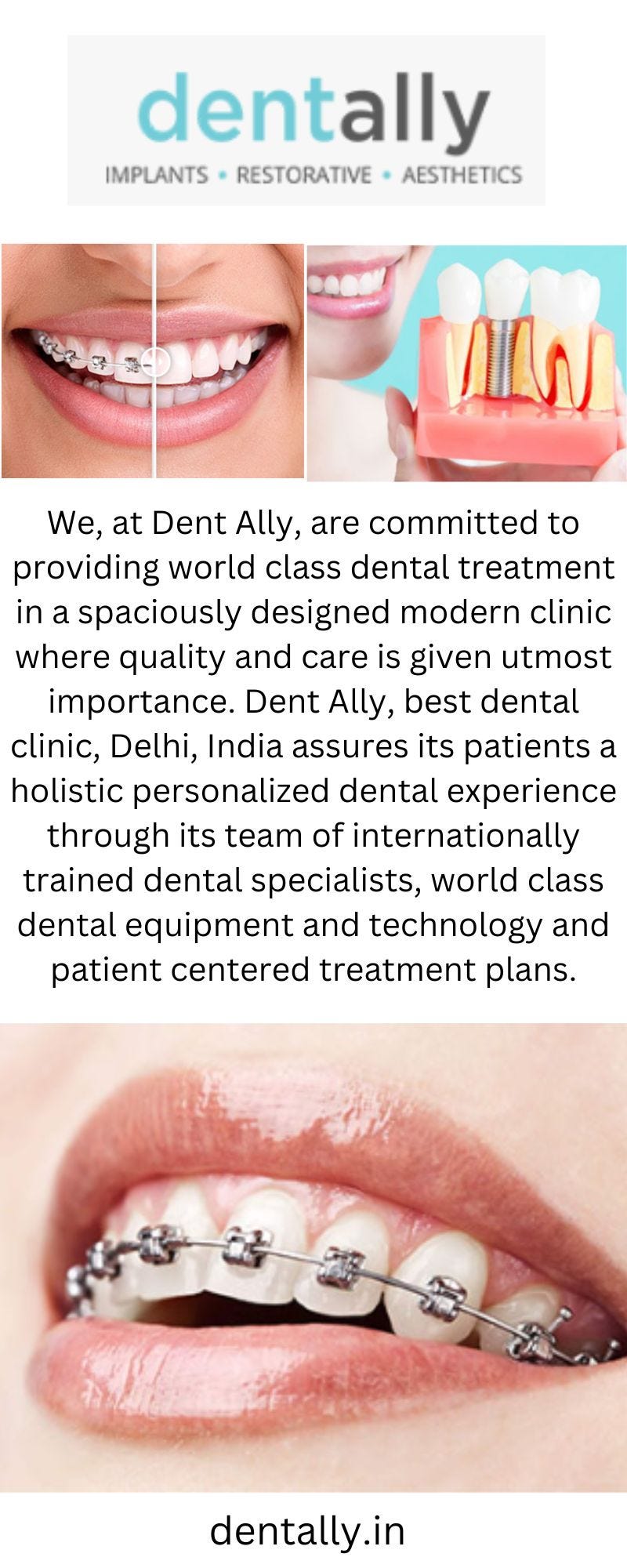 Dental Treatment In Gurgaon | Dentally.in - Dentally - Medium