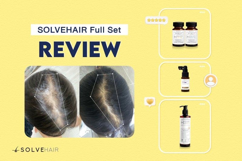 ผู้ใช้จริงยืนยัน #รีวิวSOLVEHAIR 👍🏻 ️ - นรินทร คำซอน - Medium