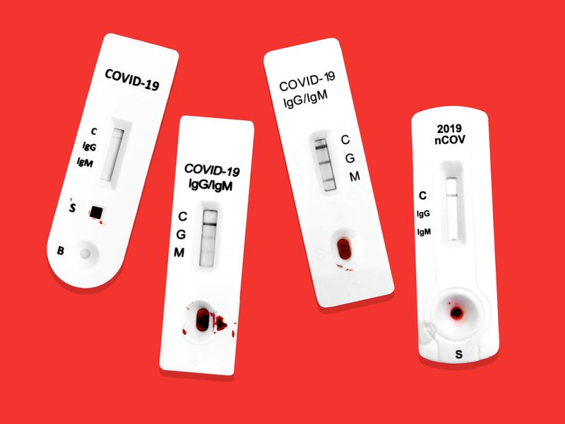 SARS-CoV-2 antibody rapid tests: best practices to minimize false ...