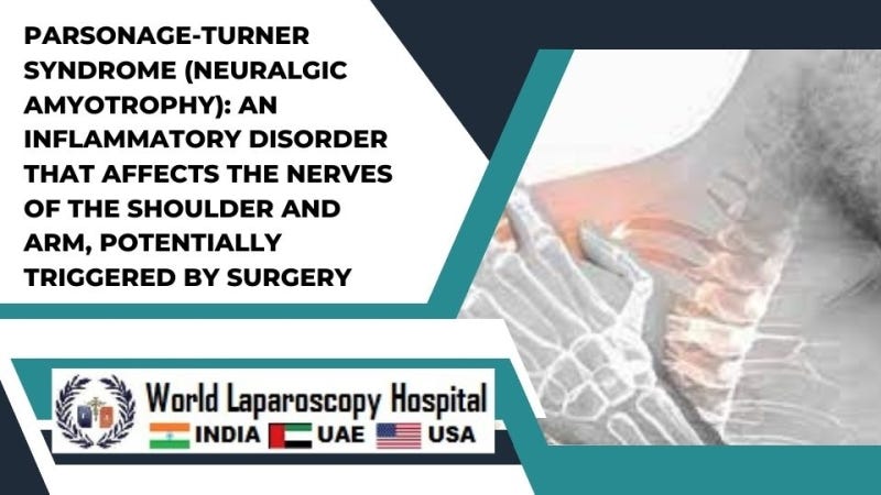Parsonage Turner Syndrome Treatment – BYZOK