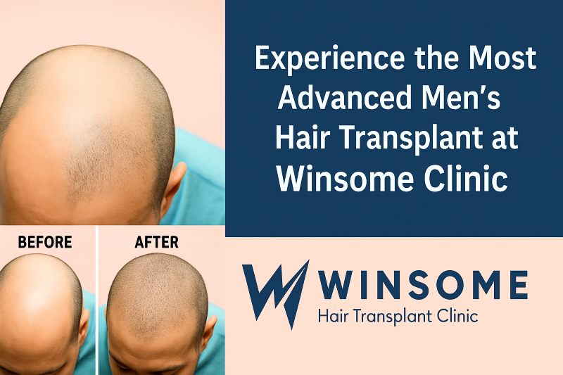 Experience the Most Advanced Men’s Hair Transplant at Winsome Clinic | by Winsome Hair ...