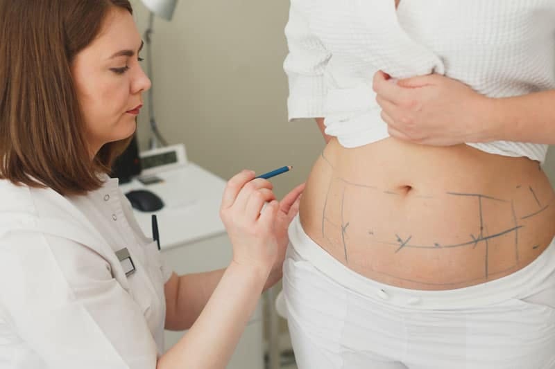 Liposuction for a More Defined, Toned Waistline | by health and beauty ...