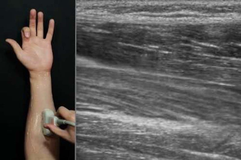 Using Ultrasound Imaging for Gesture Control with EchoFlex | by Cameron ...