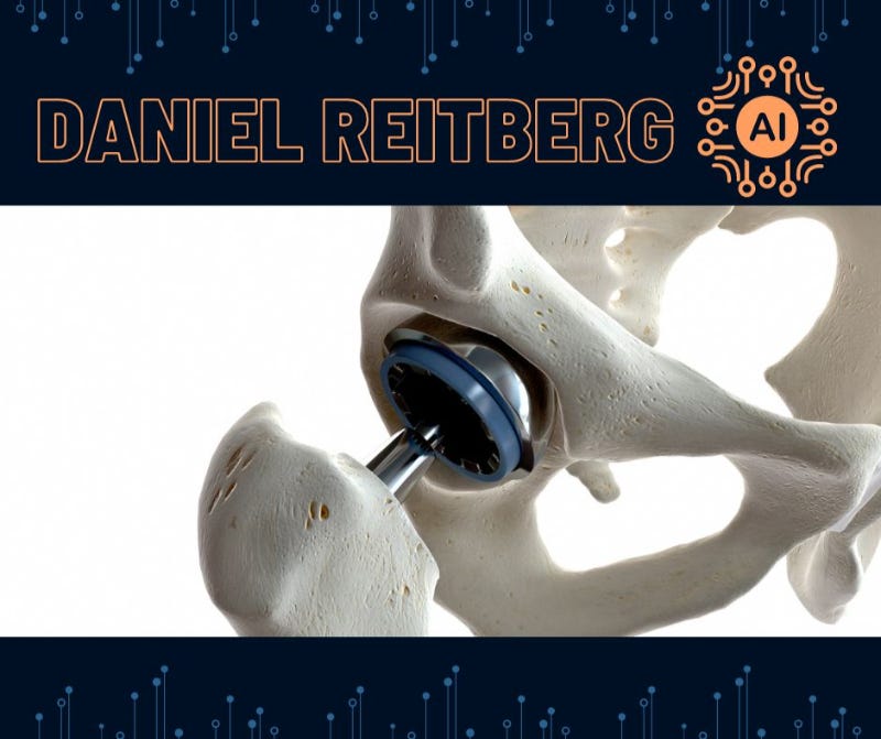 The Rise of “Smart” Implants: How AI is Transforming Orthopedics from ...