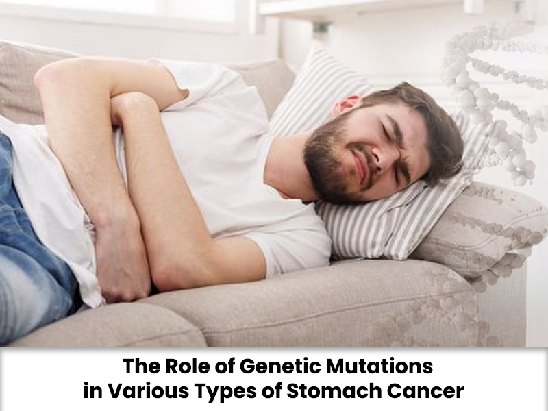 The Role of Genetic Mutations in Various Types of Stomach Cancer | by ...
