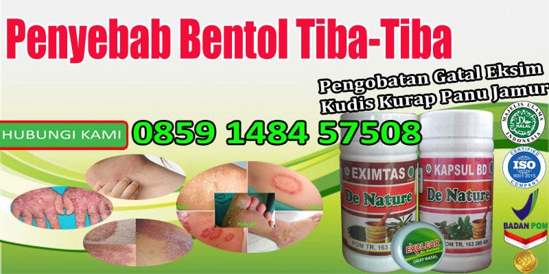 Penyebab Bentol Tiba-Tiba. Menderita penyakit Eksim /gatal tentu… | by ...