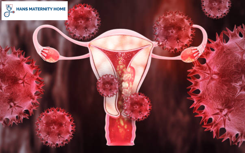 Addressing Recurrent UTIs: Exploring Effective Treatment Strategies ...