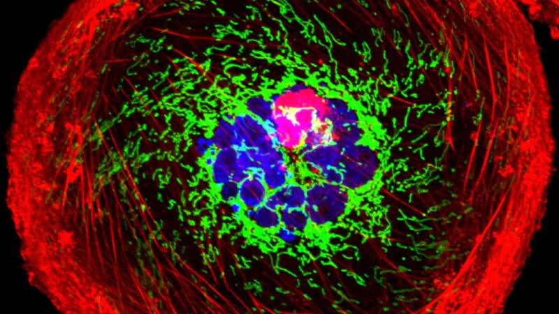 Triple-negative breast cancer highlights the need Syridex Bio ...