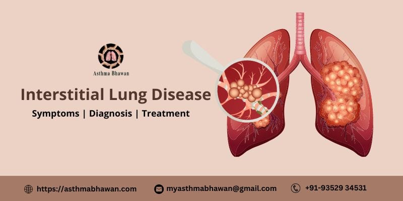 ILD Screening, Diagnosis & Treatment | by Asthma Bhawan | Oct, 2023 ...