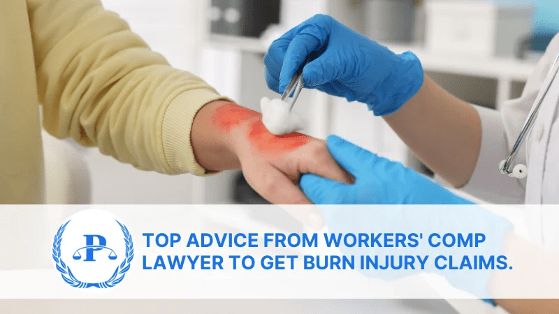 Crushed by Burn Injury? Top Tips for getting burn injury claims from ...