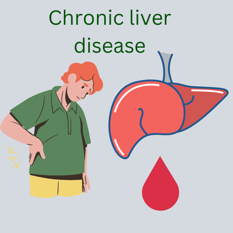 Chronic liver disease symptoms arise from fibrosis and cirrhosis of the ...