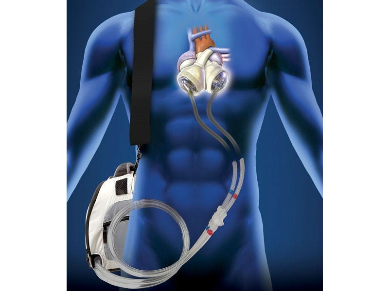 The Story of the Artificial Heart Gives New Meaning to Being on The ...