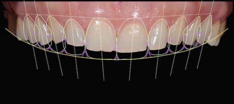 What is Digital Dental Design?. Dental Design Studio is a full-service ...