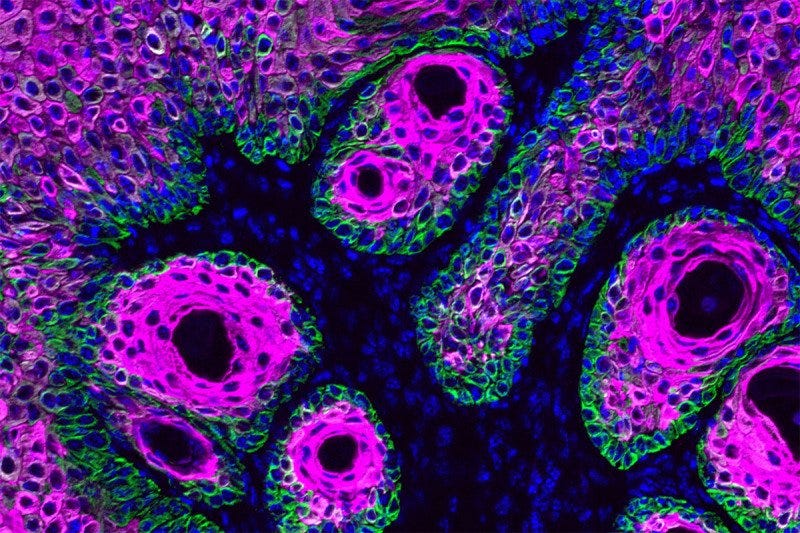 The Notorious Beginnings: Why have most cancers remained incurable ...