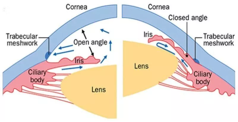Dr. Luna Xu: Your Trusted Glaucoma Specialist in Staten Island | by ...