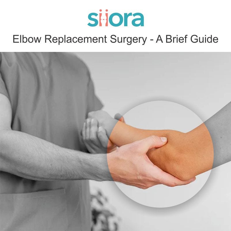 Elbow Replacement Surgery — A Brief Guide - Siora surgical - Medium