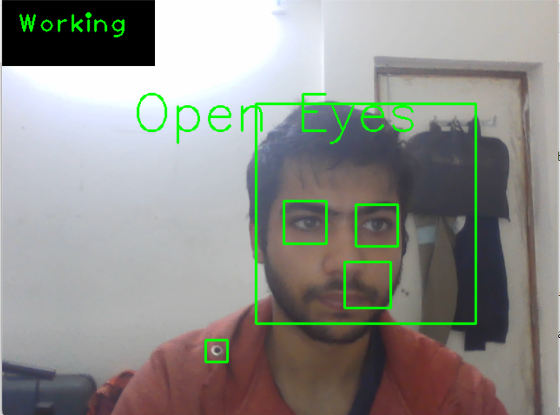 Drowsiness Detection: How Computer Vision Can Help Saving Lives | by ...