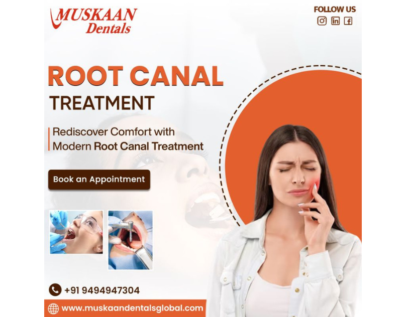 Root Canal Treatment. Looking for Painless & Best Root Canal… | by Muskaan Dentals | Nov, 2023 ...