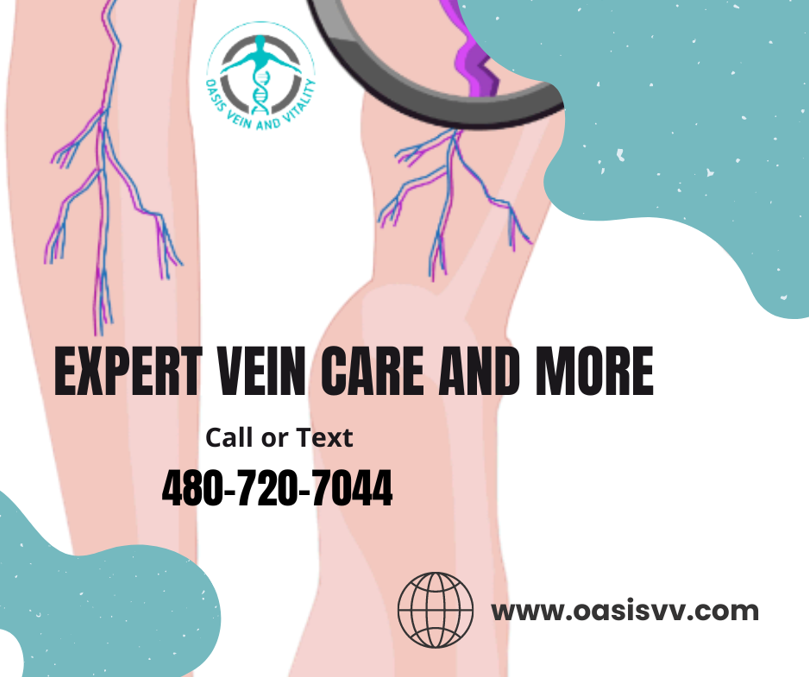 Expert vein care - Oasis Vein and Vitality - Medium
