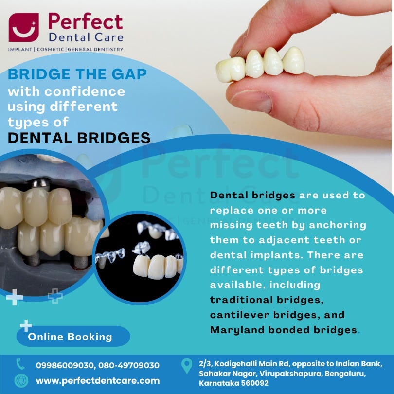 Bridge the Gap with Confidence: Types of Dental Bridges at Perfect Dental Care, Sahakarnagar ...
