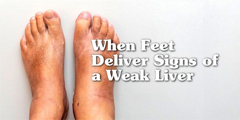 When Feet Deliver Signs of a Weak Liver | by Ida L Fanelli | Medium