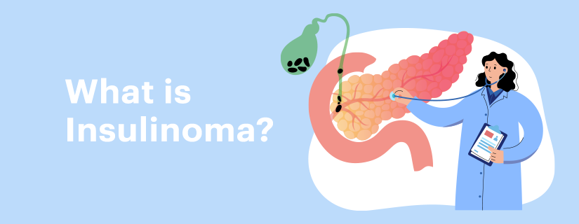 What is Insulinoma?. Insulinoma is a rare type of pancreatic… | by ...