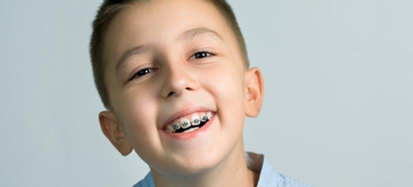 Understanding The Need For Early Child Braces | by childrensdentistry ...