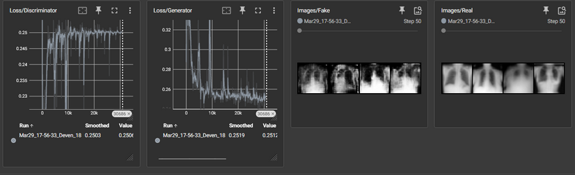 Generating Chest X-rays with GANs: A Comparison of LSGAN, WGAN & WGAN-GP | by Devendhake | Apr ...