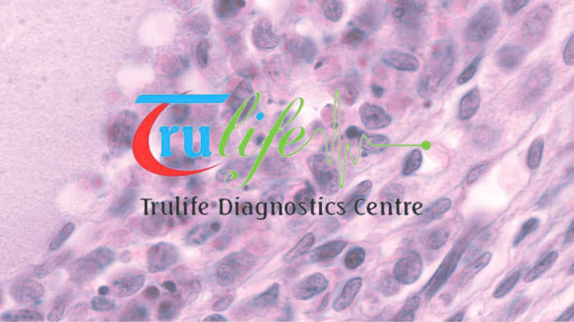 Follicular Monitoring Test Centres In Ameerpet Hyderabad — Trulife ...