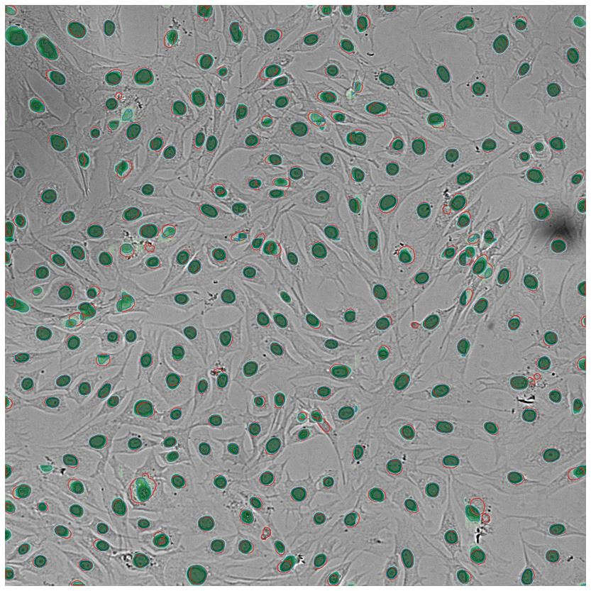 Analyzing microscopy images with transformers and CNNs | by Aleksandr ...