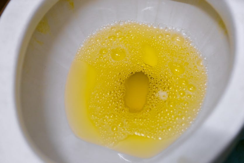 What Causes Cloudy Urine in Men?. Cloudy urine in men can be a ...