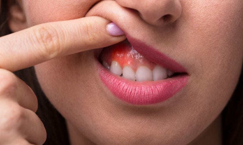 How to Protect Your Teeth From Gum Disease and Infection | by ...