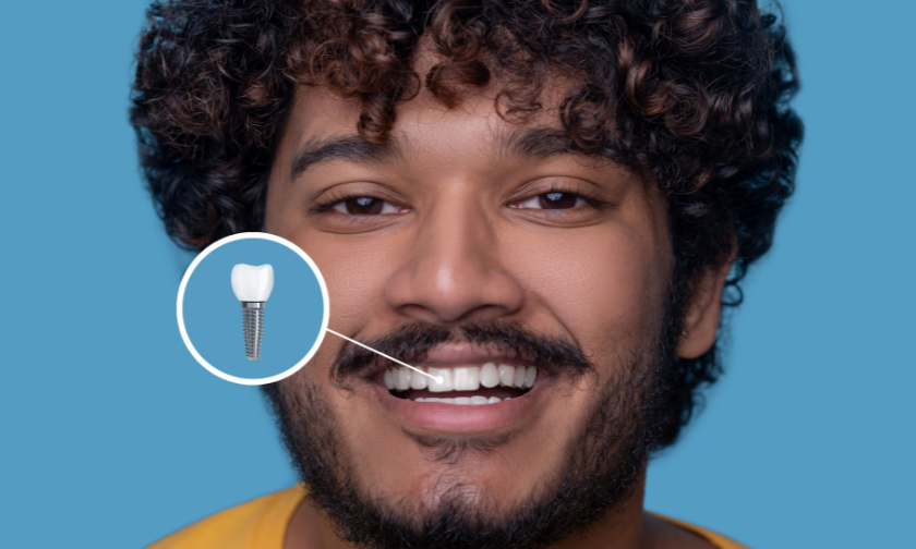 Rebuild Your Smile Using Dental Implants - Smiles of punta gorda - Medium