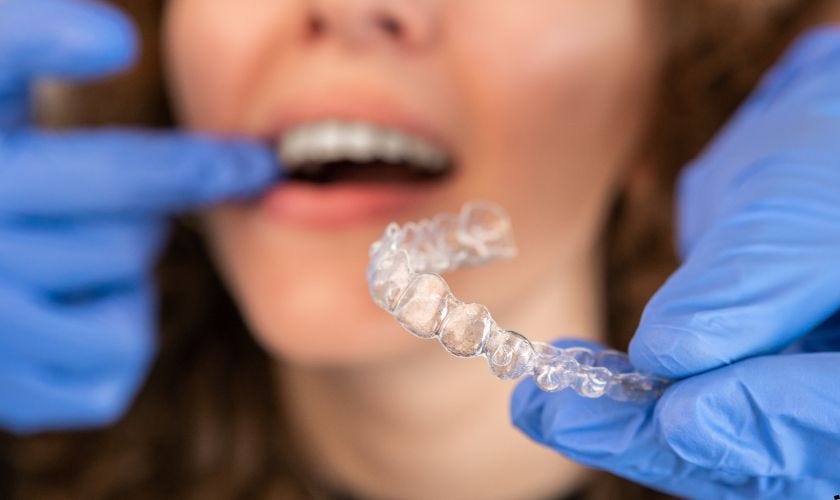 Common Myths and Misconceptions About Invisalign | by Red and Ritchey orthodontics | May, 2024 ...