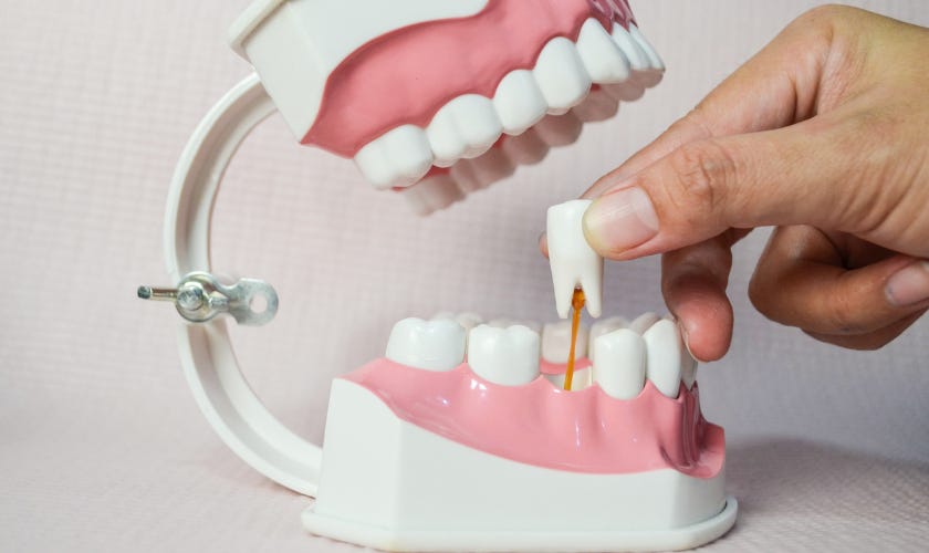 Removing Problematic Teeth: What You Need to Know About Teeth ...
