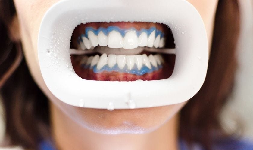 Functional Benefits of Cosmetic Teeth Bonding | Medium