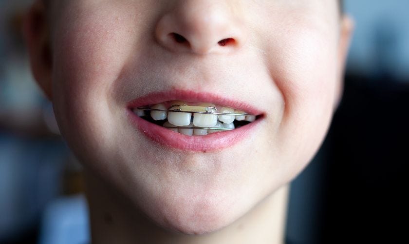 When to See an Orthodontist: Signs That It’s Time for a Consultation ...
