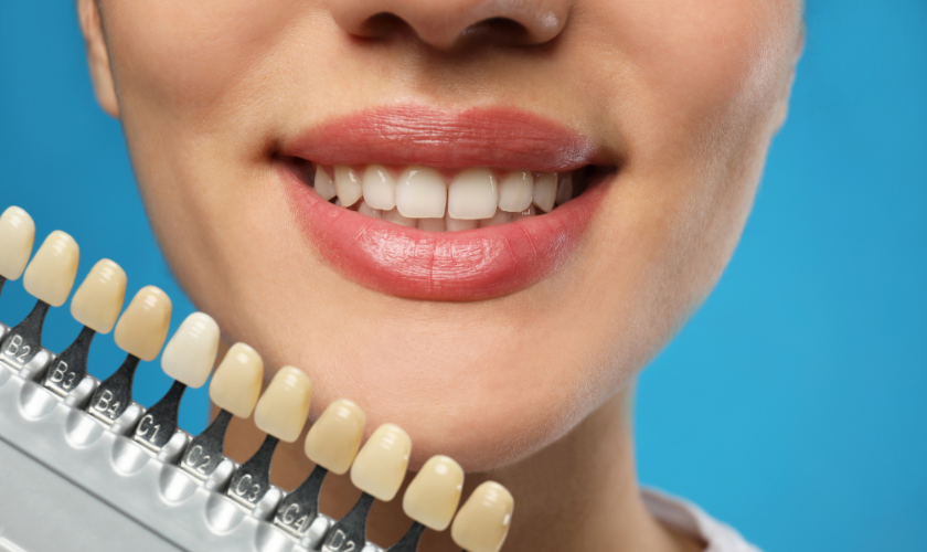 Transform Your Smile with Cosmetic Dentistry | by DFW smiles | May ...