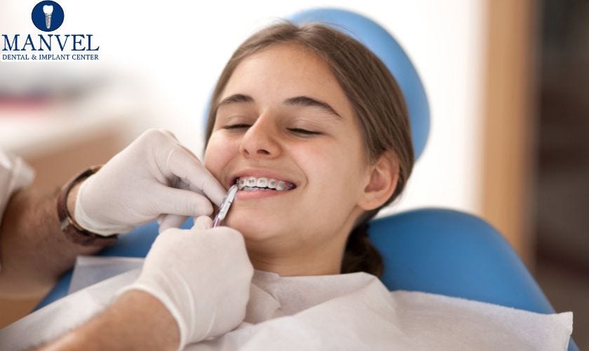 5 Benefits Of Fast Braces That Will Transform Your Smile - Manvel ...