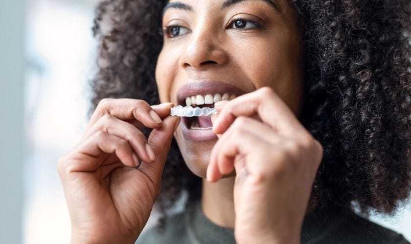 Invisalign to Fix Overbite: Your Guide to a Perfect Smile | Medium