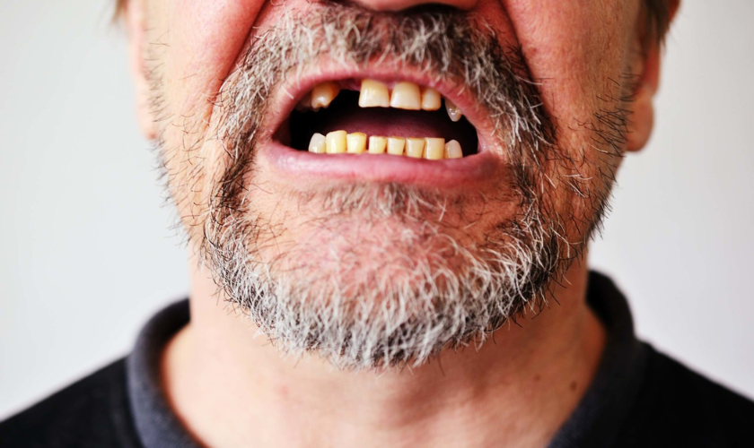 The Tooth Fairy's Dilemma: Understanding the Consequences of Losing an ...