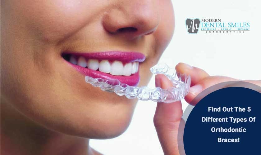 Find Out The 5 Different Types Of Orthodontic Braces! | by Modern ...