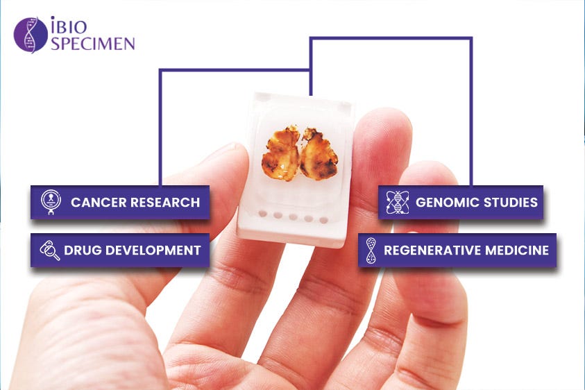 Fresh Tissue for Sale Research: An Expert’s Guide | by IBio Specimen ...